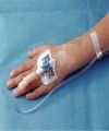 3 M Tegaderm CHG IV Securement Dressing, 1660R, 7 cm x 8.5 cm (2-3/4 in ...