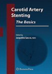 Carotid Artery Stenting: The Basics (Hb) : SAW J.: Amazon.in: Books