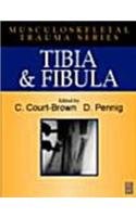 Tibia and Fibula: 9780750649803: Medicine & Health Science Books ...