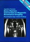 Bone Marrow Conversion in Magnetic Resonance Imaging: 9783894123772 ...