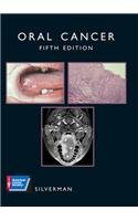 Oral Cancer (American Cancer Society Atlas of Clinical Oncology ...
