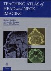 Teaching Atlas of Head and Neck Imaging: Robert B. Lufkin ...