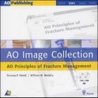 AO Image Collection: AO Principles of Fracture Management: Ruedi ...