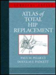 Atlas of Total Hip Replacement: Buy Online at Best Price in Egypt ...