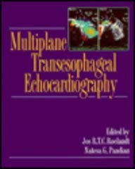Multiplane Transesophageal Echocardiography | Amazon.com.br