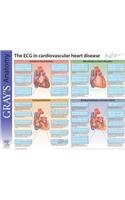Understanding the ECG: Gray's Anatomy Poster Series | Amazon.com.br