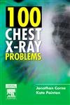 100 Chest X-Ray Problems: Corne MA PhD MB BS FRCP, Jonathan, Pointon ...