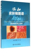 Amazon.com: Dermoscopy Atlas Concorde(Chinese Edition): 9787117205658 ...
