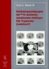 Entzündungszintigraphie mit 99mTC-markierten monoklonalen Antikörper ...