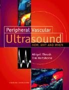 Peripheral Vascular Ultrasound: How, Why, When: Amazon.co.uk: Thrush ...