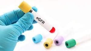 Zyrex Herbal GFR Support Tablets-360 Tablets An Ayurvedic Remedy That ...