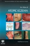 Buy AN ATLAS OF ATOPIC ECZEMA Book Online at Low Prices in India | AN ...