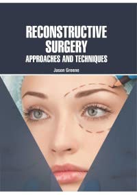 Reconstructive Surgery: Approaches And Techniques : Amazon.in: Books
