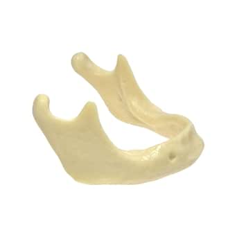 Amazon.com: Dental Typodont Modle lmplant Practice Model - Low Jaw ...