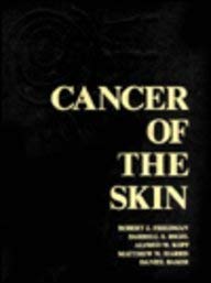 Cancer of the Skin: 9780721623283: Medicine & Health Science Books ...