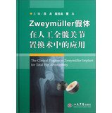 The Clinical Practice of Zweymuller Implant for Total Hip Arthroplasty ...