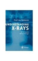 Understanding X-Rays: A Synopsis of Radiology - | 9788181281517 ...
