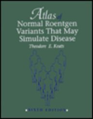 Amazon | Atlas of Normal Roentgen Variants That May Simulate Disease ...