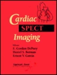 Cardiac Spect Imaging: e-gordon-depuey-daniel-s-berman-ernest-v-garcia ...