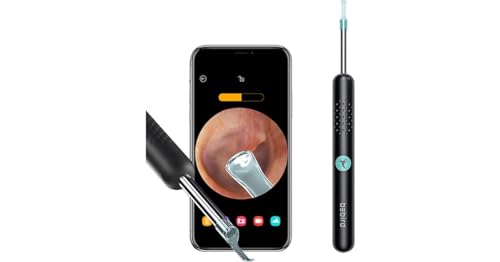 BEBIRD R1 Wax Removal Tool for Ear - Spade Ear Canal Cleaner with ...