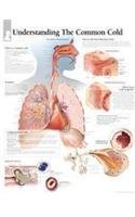 Buy Understanding the Common Cold Laminated Poster Book Online at Low ...