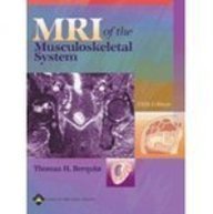 Mri: Musculoskeletal System: 9780397446445: Medicine & Health Science ...
