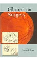 Glaucoma Surgery (Book & DVD): 9780824727437: Medicine & Health Science ...