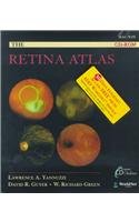 The Retina Atlas CD-ROM: 9780815102694: Medicine & Health Science Books ...