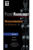 Pocket Radiologist : Musculoskeletal Top 100 Diagnoses: Stoller ...