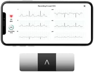 KardiaMobile Six-Lead Personal EKG Monitor - Detect AFib from Home - by ...