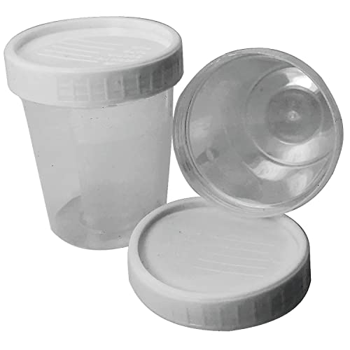 120mL Urine Sample Test Collection Cup/Pot/Bottle - with Screw on Lid ...