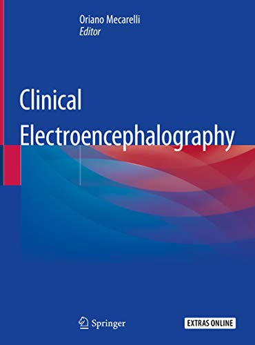 Clinical Electroencephalography eBook : Mecarelli, Oriano: Amazon.co.uk ...