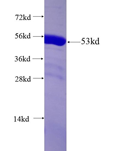 Amazon.com: Human RGS3 Fusion Protein : Industrial & Scientific