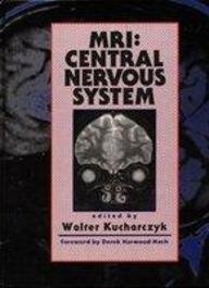 Mri: Central Nervous System: 9780397446704: Medicine & Health Science ...
