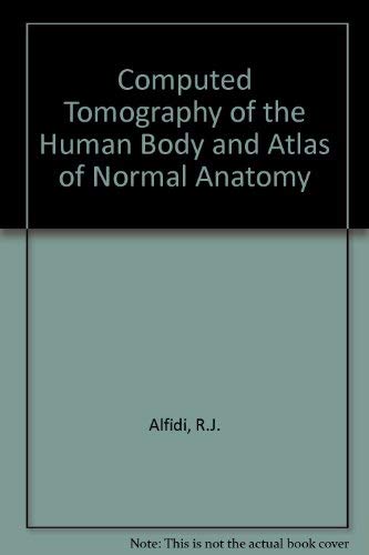Computerized Tomography of the Human Body: An Atlas of Normal Anatomy ...
