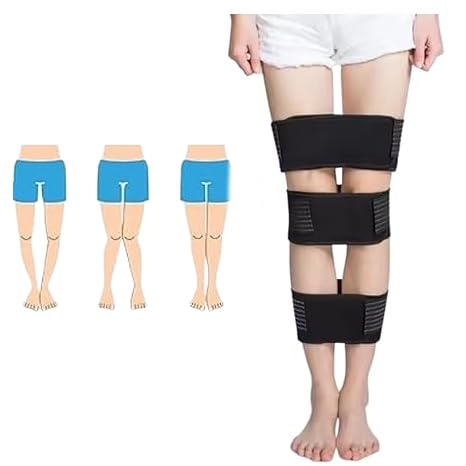 Buy CAREOPETA Bow Leg Correction Belt for Women Men, Adjustable Knock ...