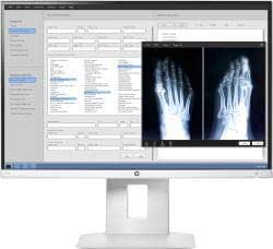HP HC240 24-Inch Healthcare Edition Display Monitor - White : Amazon.co ...