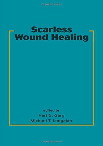 Scarless Wound Healing (Basic and Clinical Dermatology): 9780824702854 ...