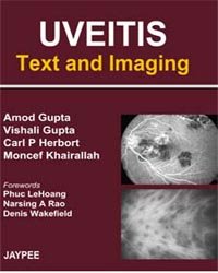 UVEITIS TEXT AND IMAGING: Amod Gupta: 9788184484915: Amazon.com: Books
