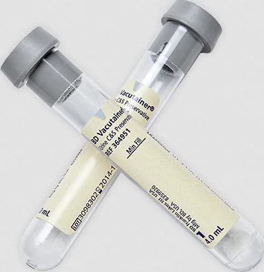 BD VACUTAINER Urine Collection System in Pakistan - StarShop.pk