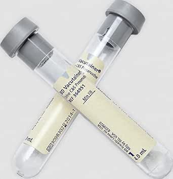 Amazon.com: BD VACUTAINER Urine Collection System : Industrial & Scientific