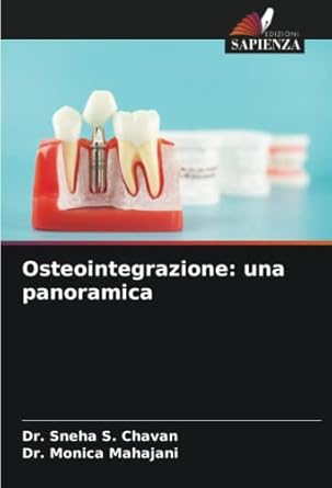 Amazon.com: Osteointegrazione: una panoramica (Italian Edition ...