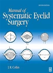 Manual of Systematic Eyelid Surgery: Buy Online at Best Price in Egypt ...