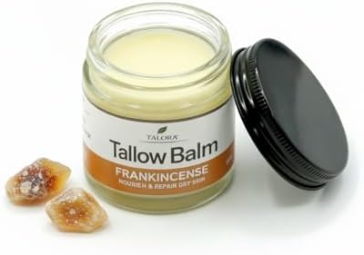 Amazon.com: TALORA Tallow Balm: Frankincense | 100% Grass-Fed ...