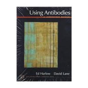 Using Antibodies: A Laboratory Manual: Ed Harlow: 9780879695439: Amazon ...