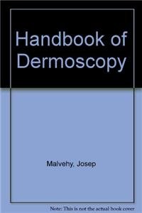 Handbook of Dermoscopy: 9781841847917: Medicine & Health Science Books ...