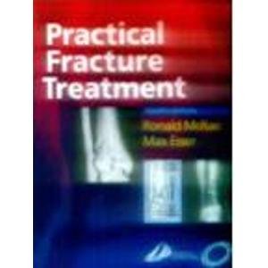 Amazon.in: Buy Practical Fracture Treatment / 4th Edn Book Online at ...
