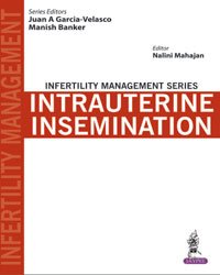 Infertility Management Series: Intrauterine Insemination: Amazon.co.uk ...