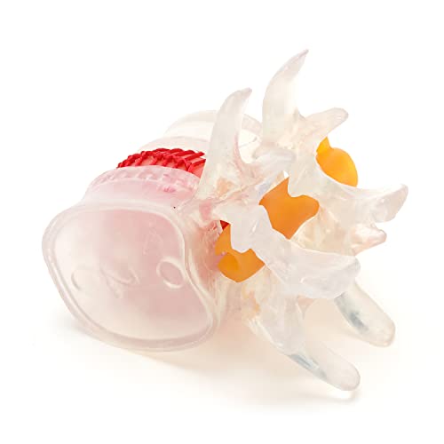 Snapklik.com : MIIRR Human Lumbar Disc Herniation Model, Transparent ...
