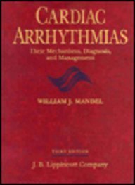Cardiac Arrhythmias: Their Mechanisms, Diagnosis, and Management ...